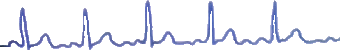 Ritmos de parada cardiorrespiratória
